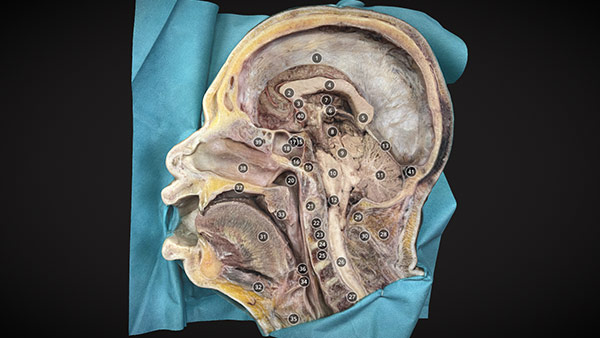 Nasal Anatomy and Paranasal sinuses - 3D Atlas of Neurological Surgery