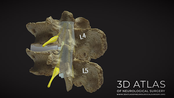 Spine and spinal cord anatomy - 3D Atlas of Neurological Surgery