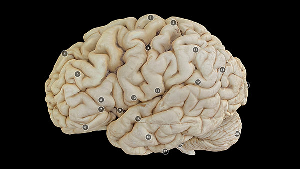 Brain anatomy - 3D Atlas of Neurological Surgery